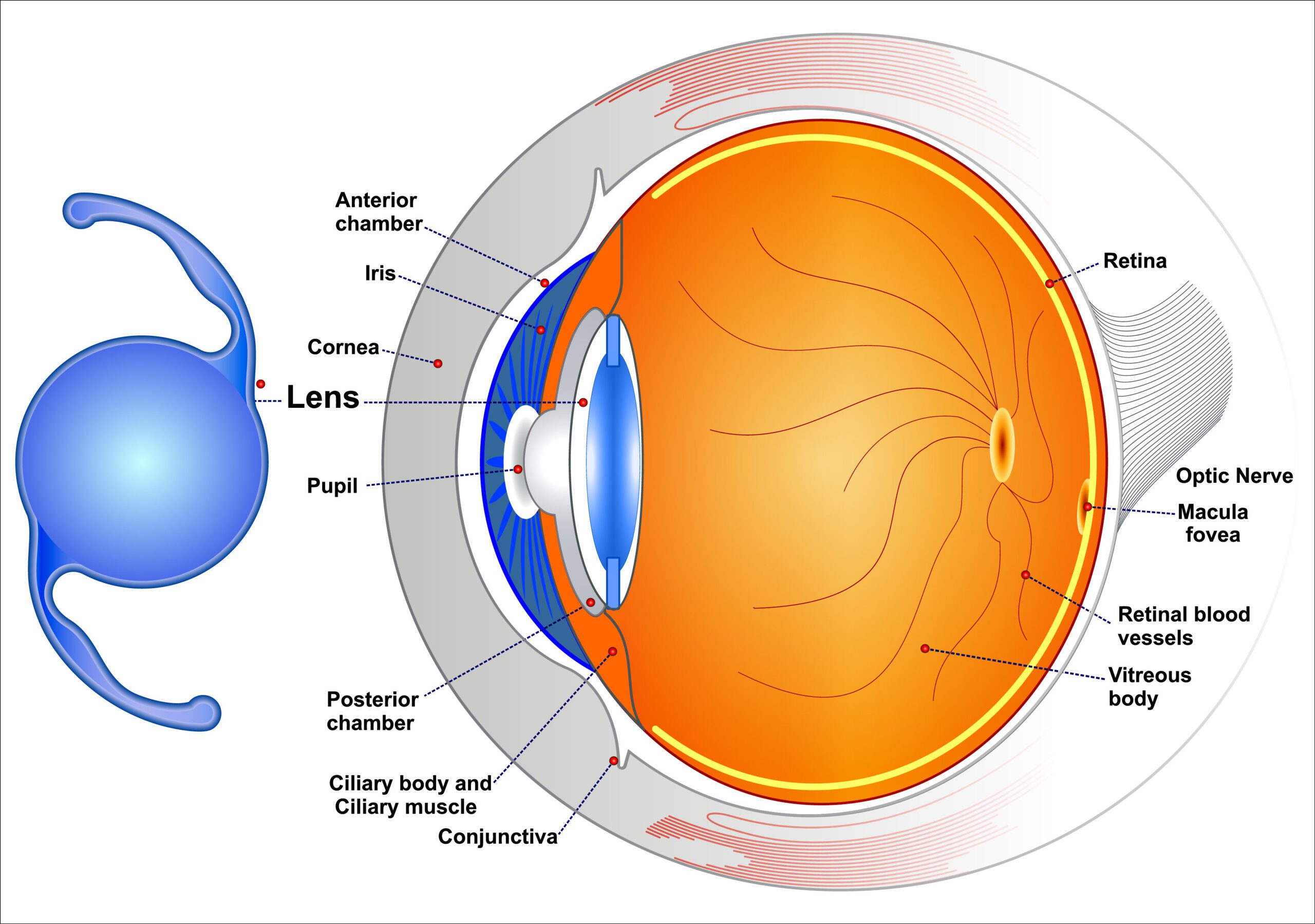 IOLs Exchanges Dr Vijay Shetty Eye Specialist